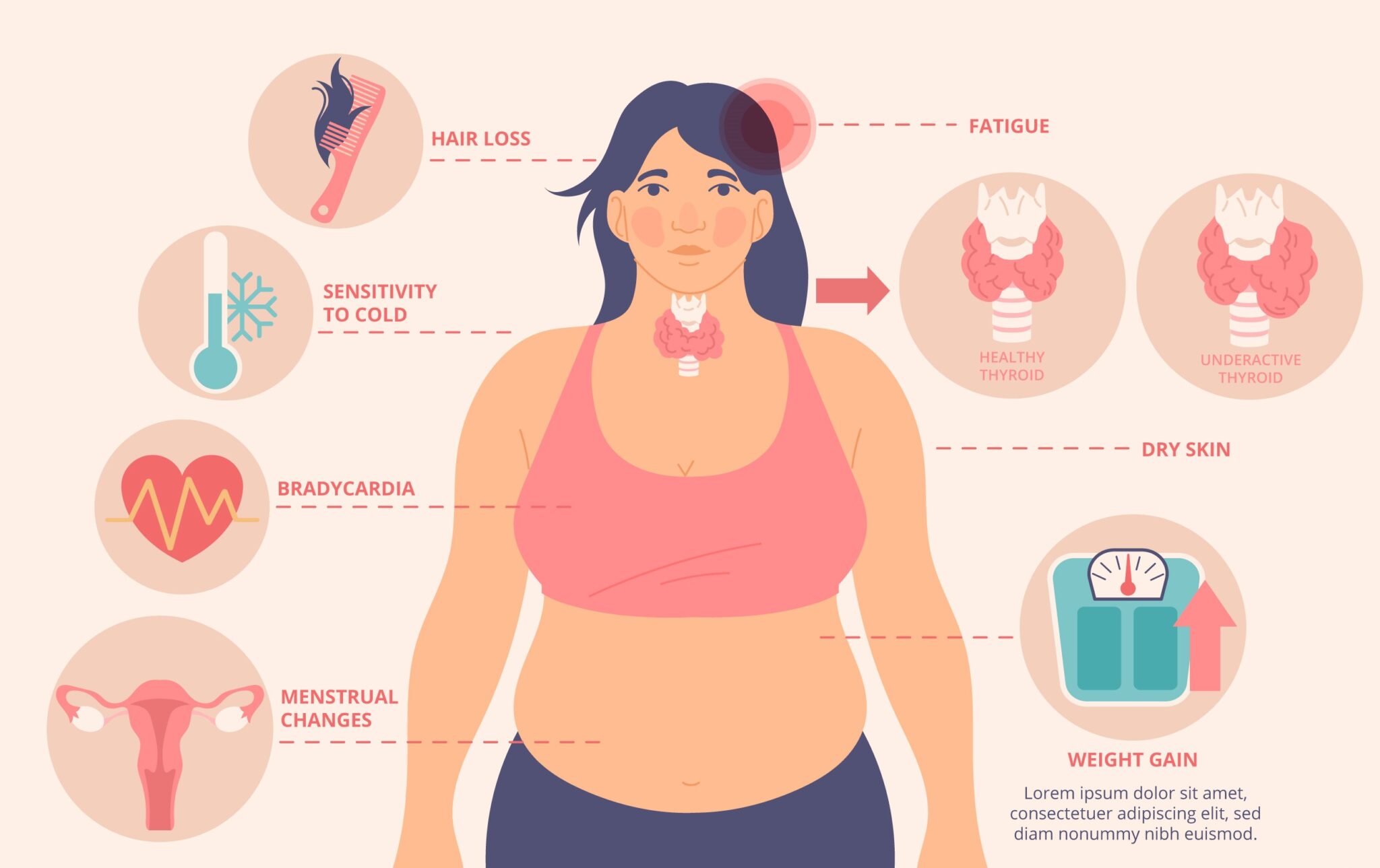 Thyroid Function Role in PCOS - Ultimate Preventive Care
